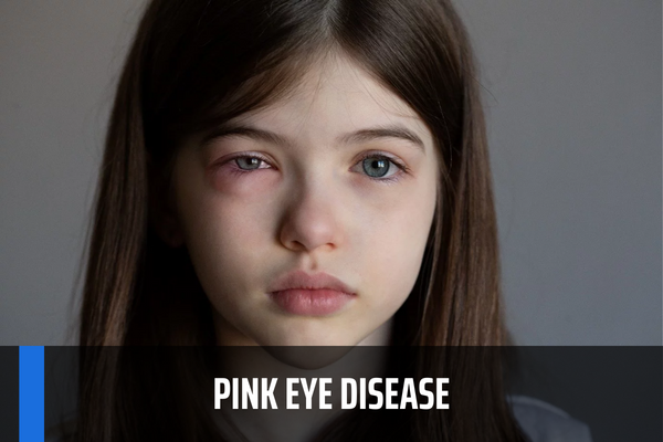 What is the most detailed pink eye propaganda article in 2023? How to ...