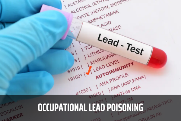 Which occupations may be at risk of occupational lead poisoning in ...